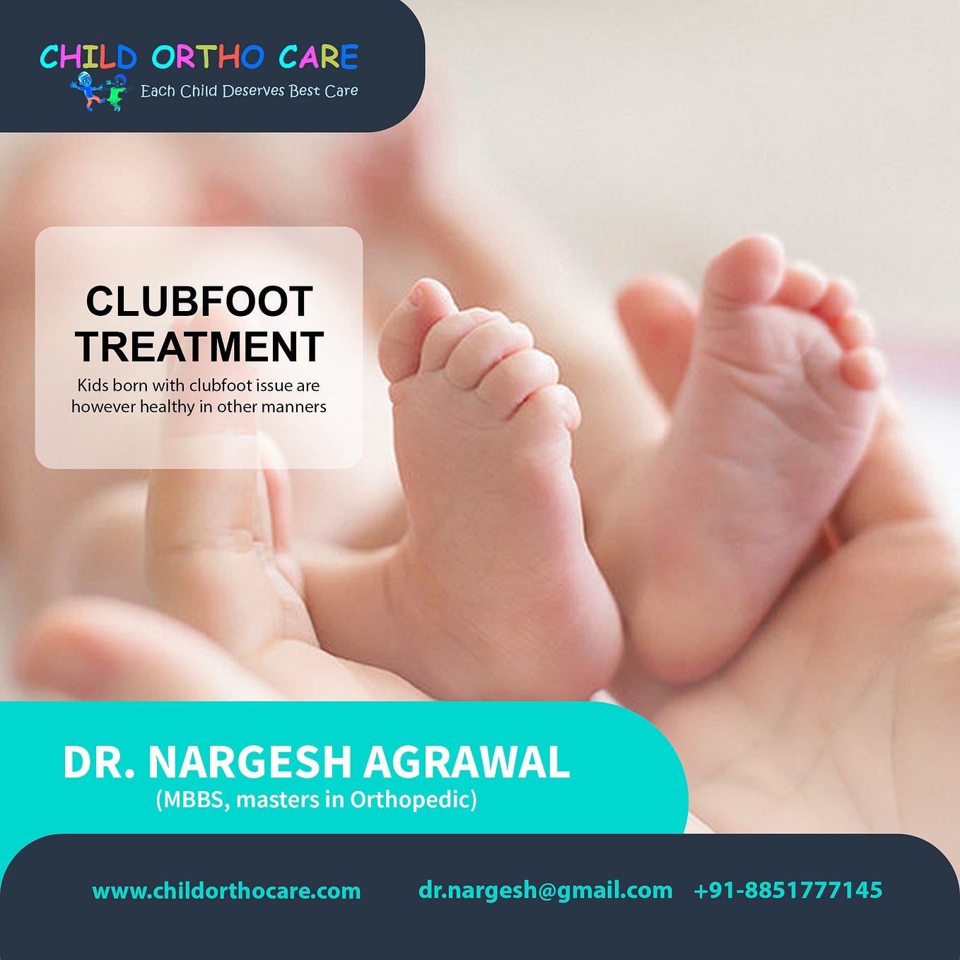 Causes of clubfoot. Who is the best orthopedic doctor in… | by ABHISHEK ...