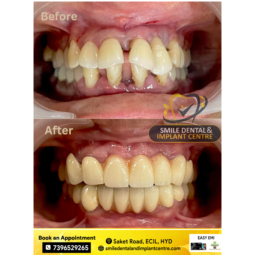 Best Dentist in Kapra | Dr Sudhakar Puli | Dentist near You | by Smile ... Best Dentist in Kapra | Dr Sudhakar Puli | Dentist near You | by Smile ...