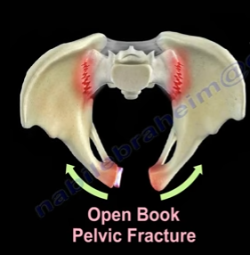 Sacral Sparing. Sacral sparing tests can be used to… | by Nabil ...