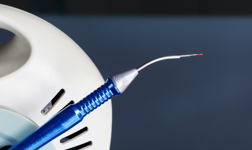 Bridging the Gap: Exploring Options for Correcting Tooth Gaps | by Jeff ...