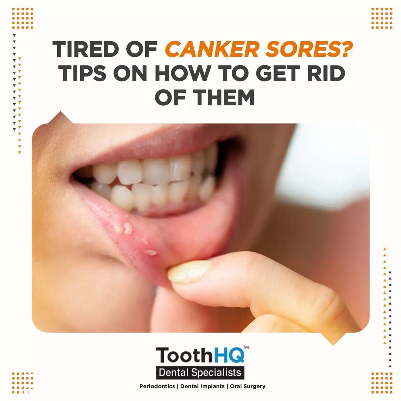 How-To Guide to Healthy Gums. Things You Need to Know About Keeping ...