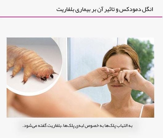 Demodex Brevis There are two kinds of Demodex mites that naturally live ...