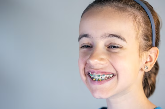 Braces for Kids in Dallas: What You Need to Know | by Dallas ...
