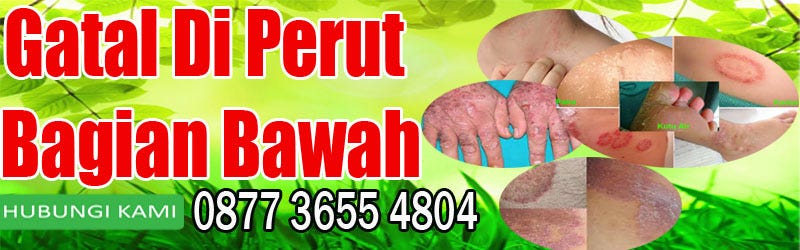 Obat Salep Gatal Di Perut. Menderita penyakit Eksim /gatal tentu… | by ...