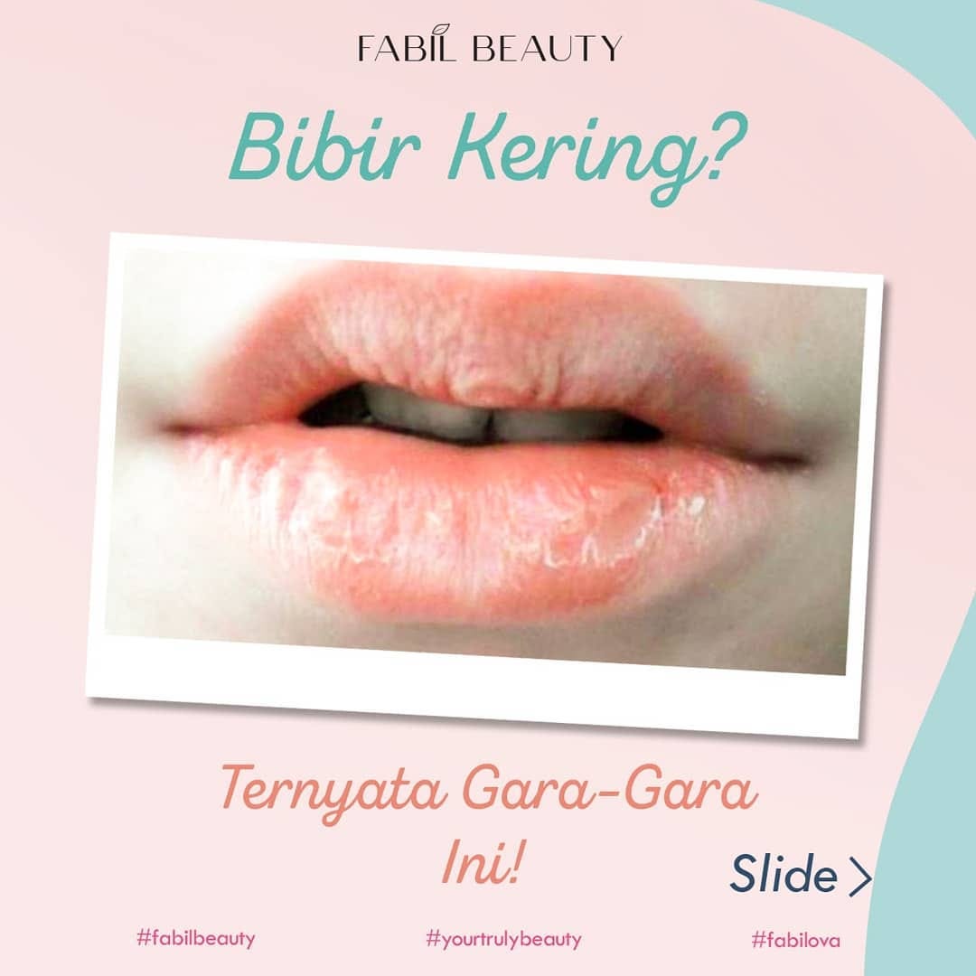 Begini Cara Mudah Mengatasi Bibir Kering dan Pecah-pecah | by fabilskinbandung | Medium