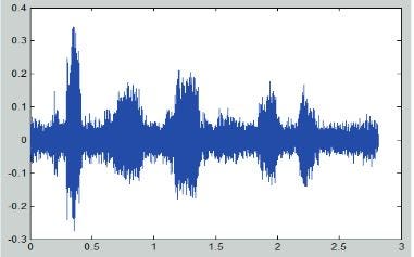 Development of Efficient VLSI Architecture for Speech Processing in Mobile Communication | by ...