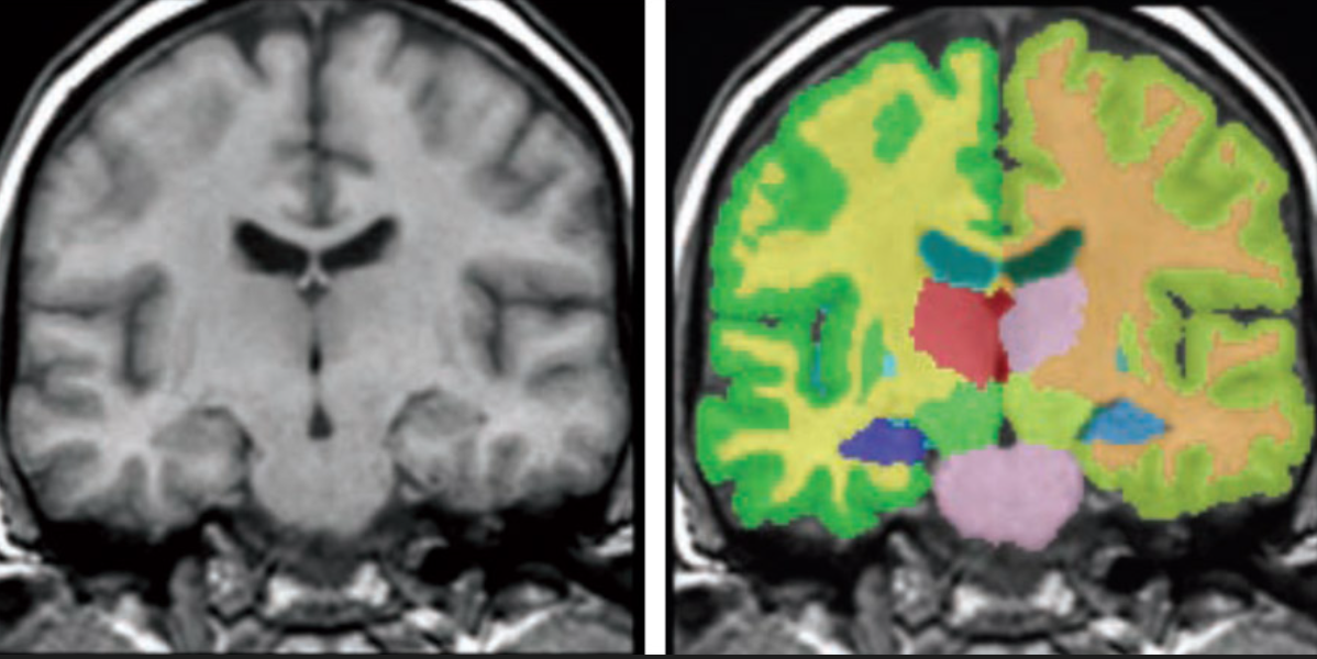 Mathematical Insights: Exploring Edge Detection, Kernels, and Filters ...
