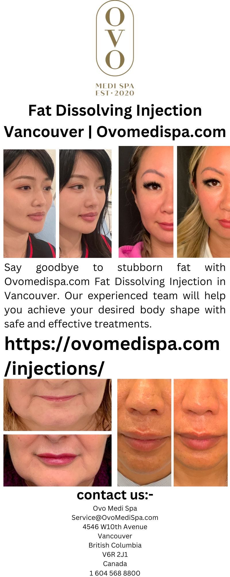 Fat Dissolving Injection Vancouver | Ovomedispa.com - Ovomedispa - Medium