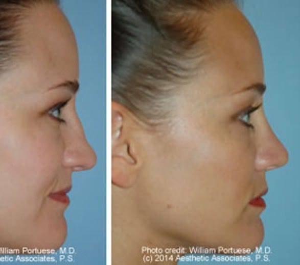 Facial Plastic Surgery Excellence in Anchorage, Alaska: Dr. William ...