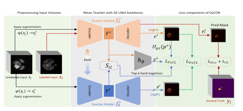 3D CNN. A 3D Convolutional Neural Network (3D… | by Saba Hesaraki | Medium
