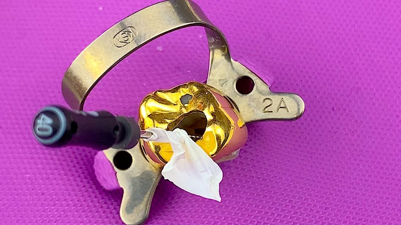 Lateral Canal Aspects in Endodontics (Ricucci) | by Ashley Mark | Medium