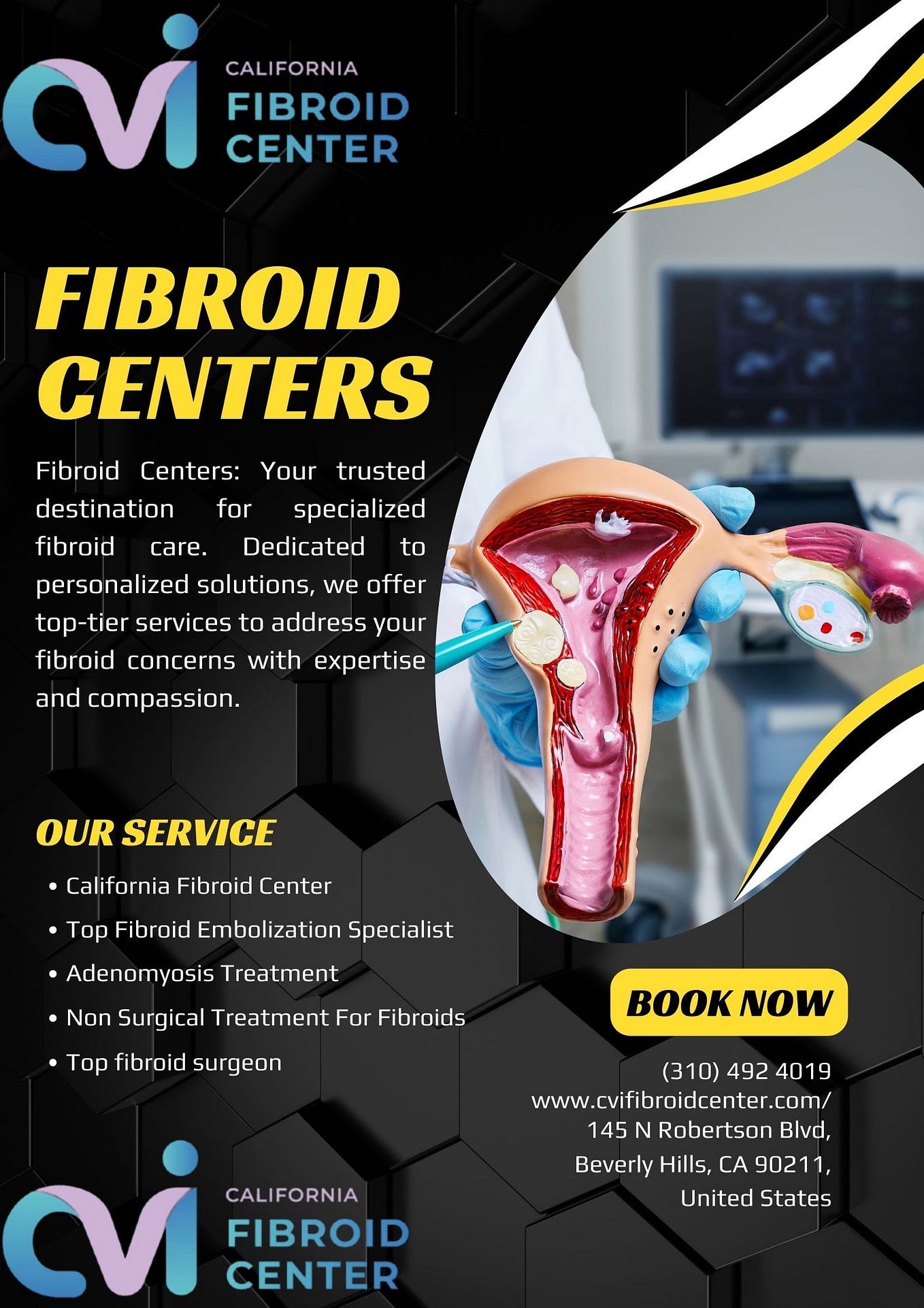 Non Surgical Fibroid Treatment - Cvifibroidcenter - Medium