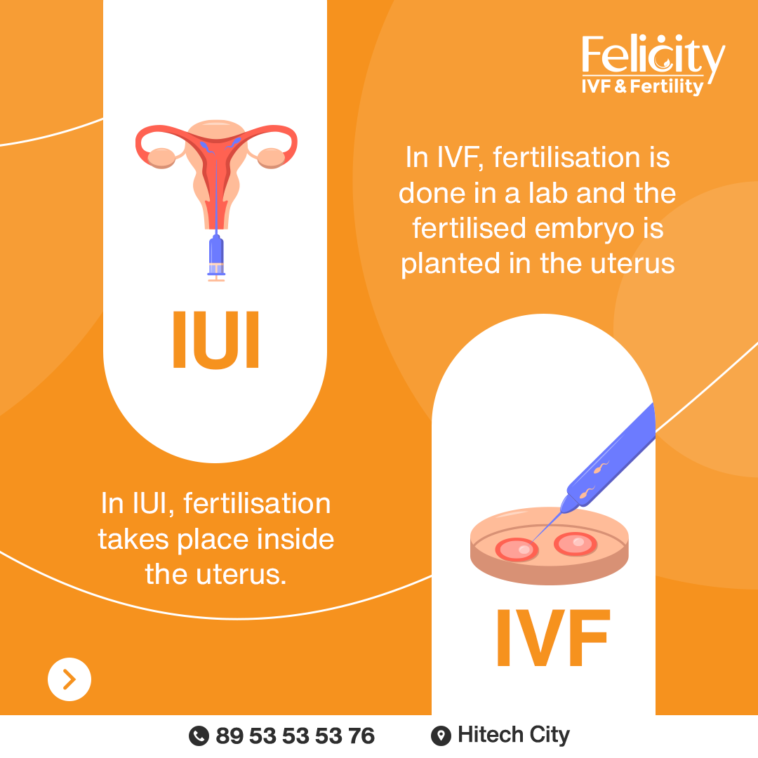Fertility center in hyderabad — Felicity IVF | by Felicity IVF ...