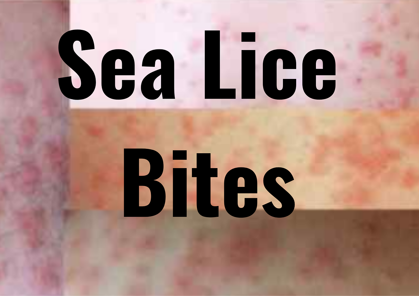 Bed Bug Bites vs Flea Bites: How to Tell the Difference | by My ...