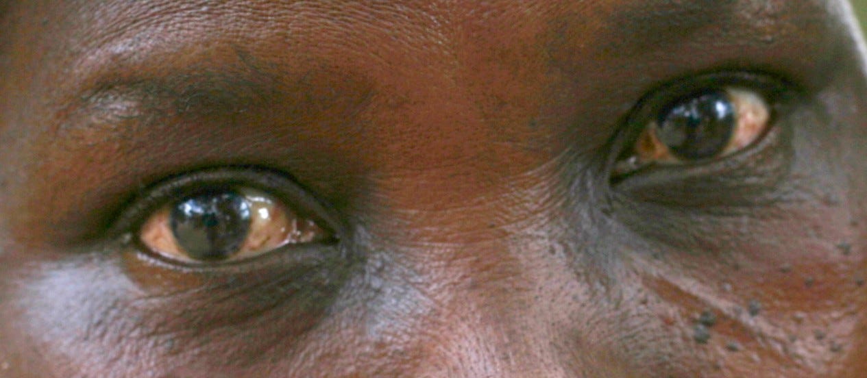 Peek Retina: a journey from idea to impact | by Peek Vision | Peek ...