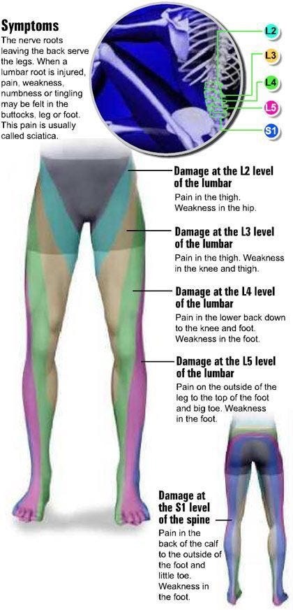 CREST Syndrome, Limited scleroderma | by Jeanette Calara | Medium