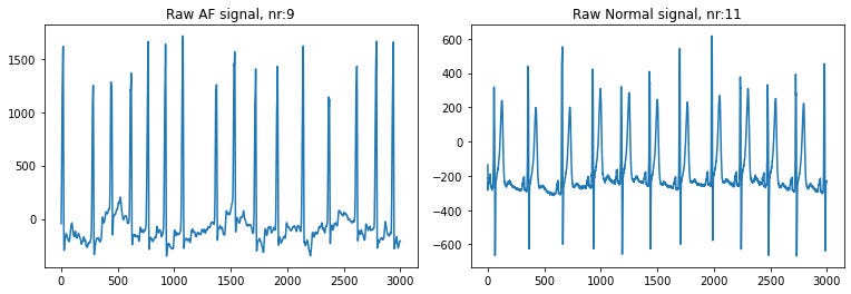 The U-Net for cell segmentation in PyTorch | by Bjørn Hansen | CodeX ...