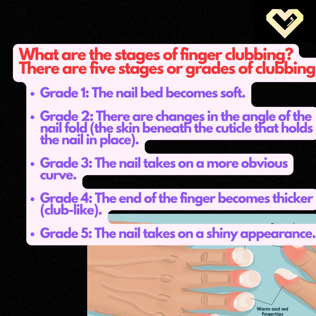 How to prevent conjunctivitis - Vesta Medcare - Medium