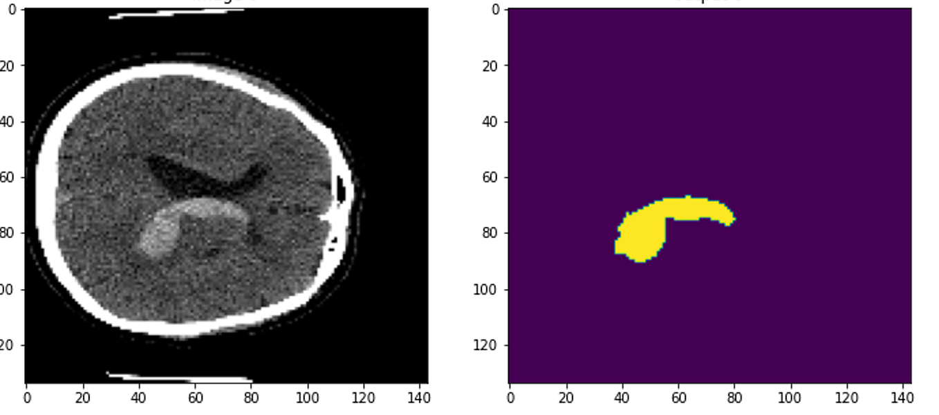 3d Vascular Segmentation Using Deep Learning By Cerebra Medium