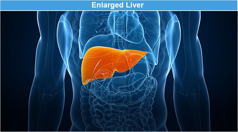 Lung Transplant Procedure and it’s risk | by Magnus Medi | Medium