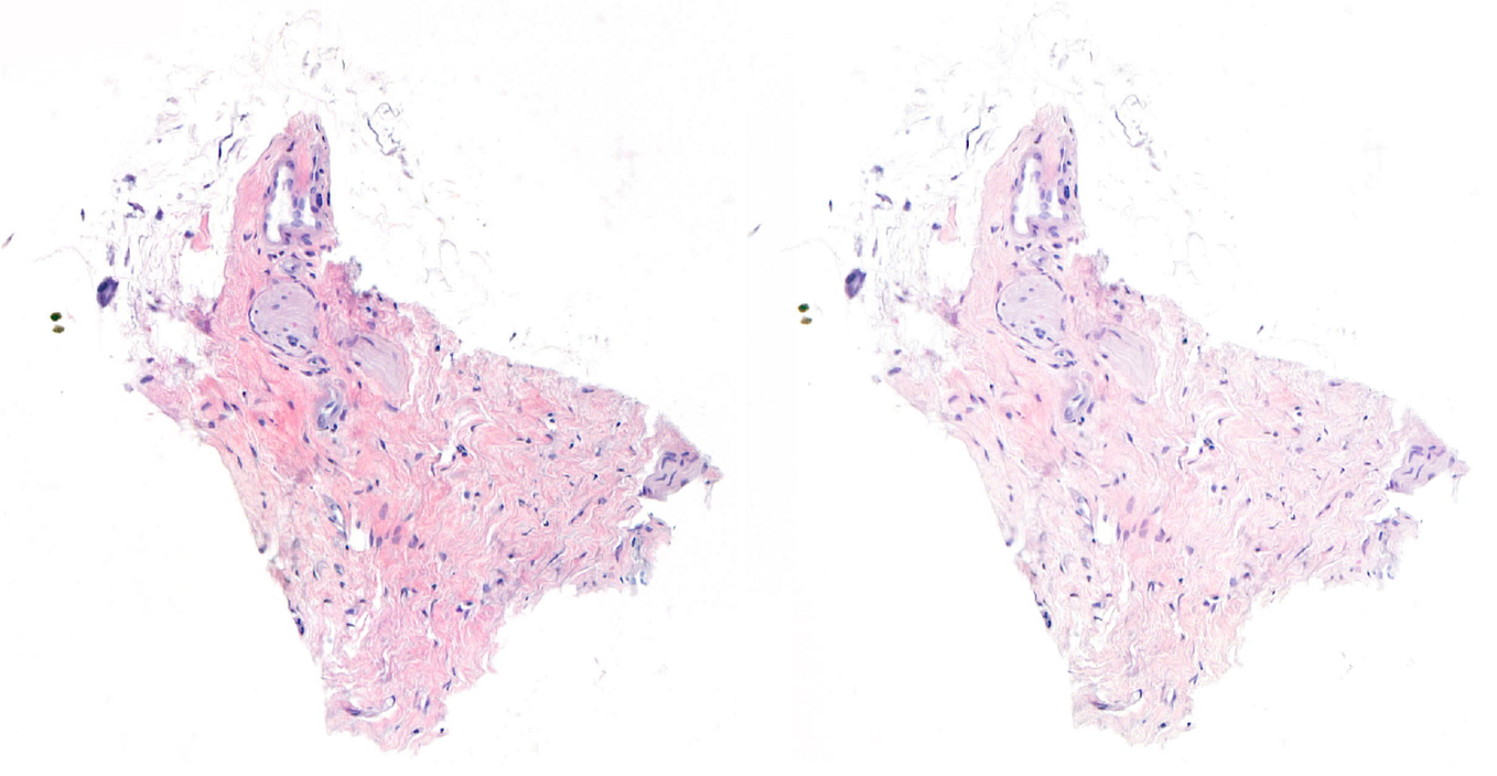 Tensorflow Lite Converter Example By Maheshwar Ligade Techwasti Medium
