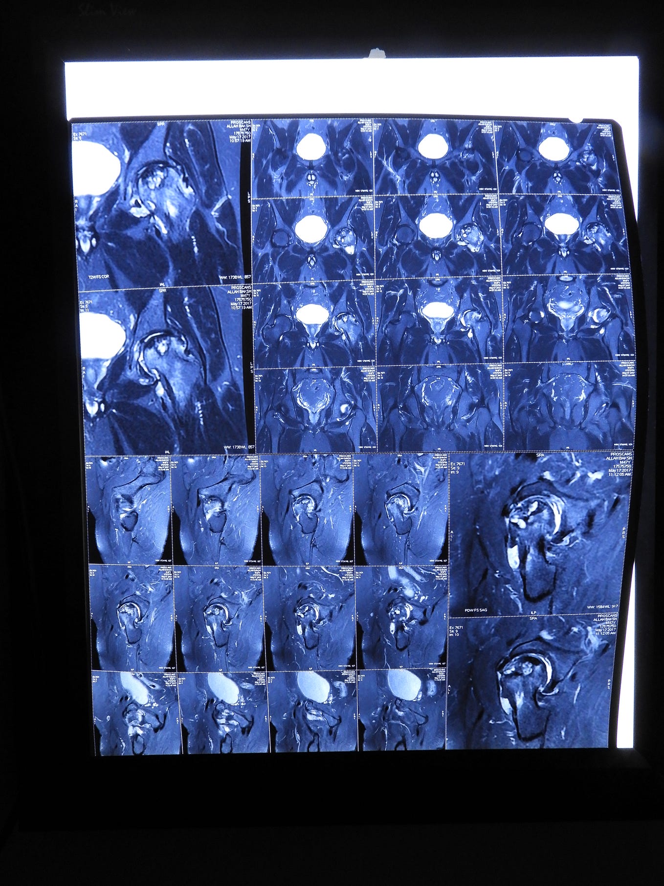 Faith Multispecialty hospital, Chennai | by Faith Hospitals, Chennai ...