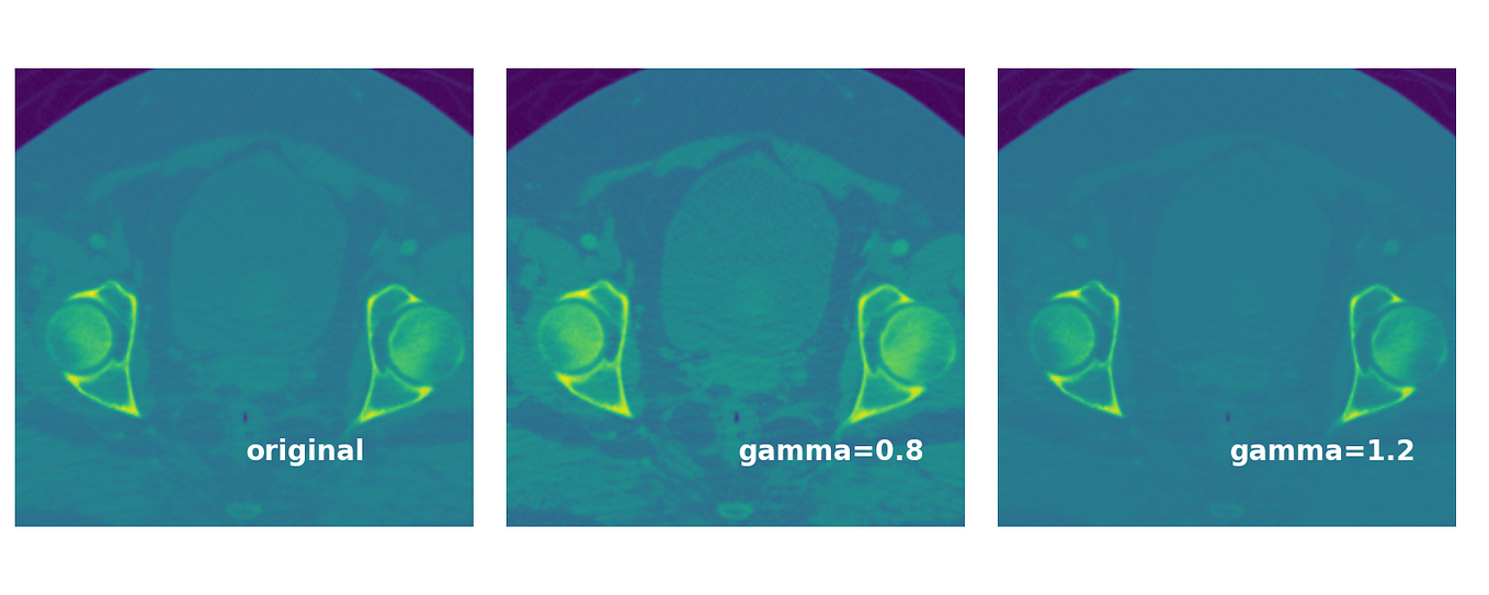 Pre-training neural networks by autoencoders for ECG processing | by Rostepifanov | Medium