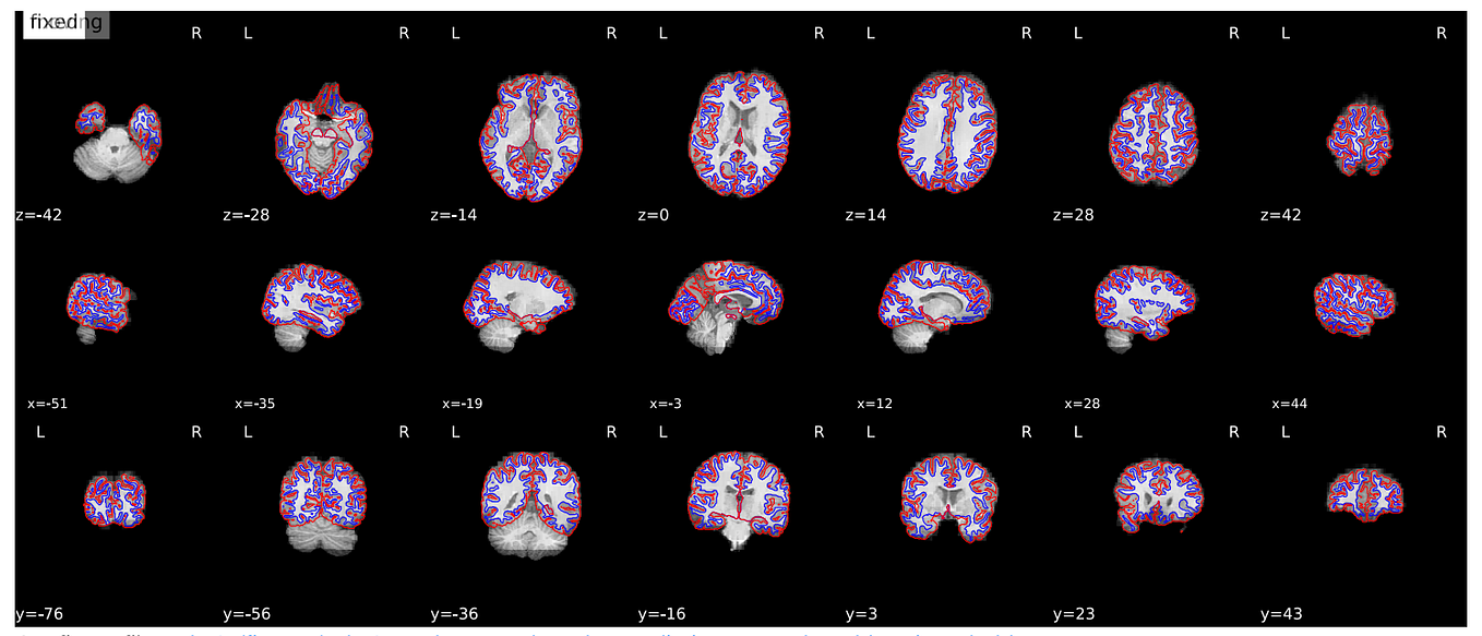 Using neural networks for a functional connectivity classification of ...
