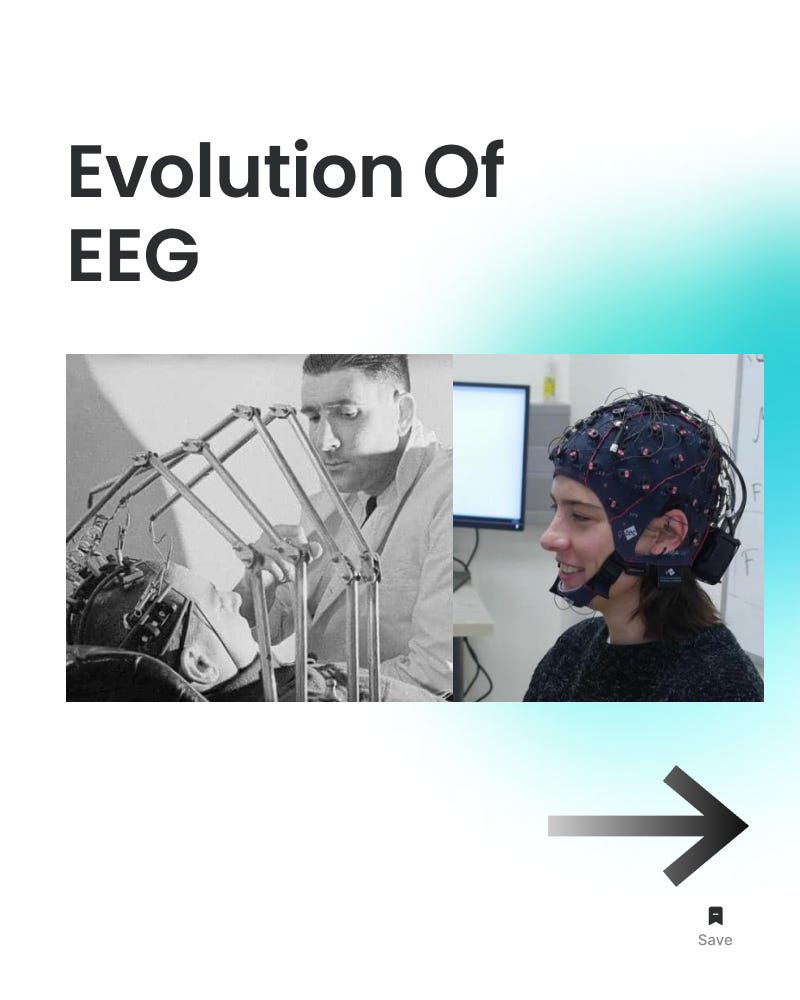 Getting Started With Eeg Analysis Using Mne Python A Beginners Guide By Manish Thilagar Medium 3277