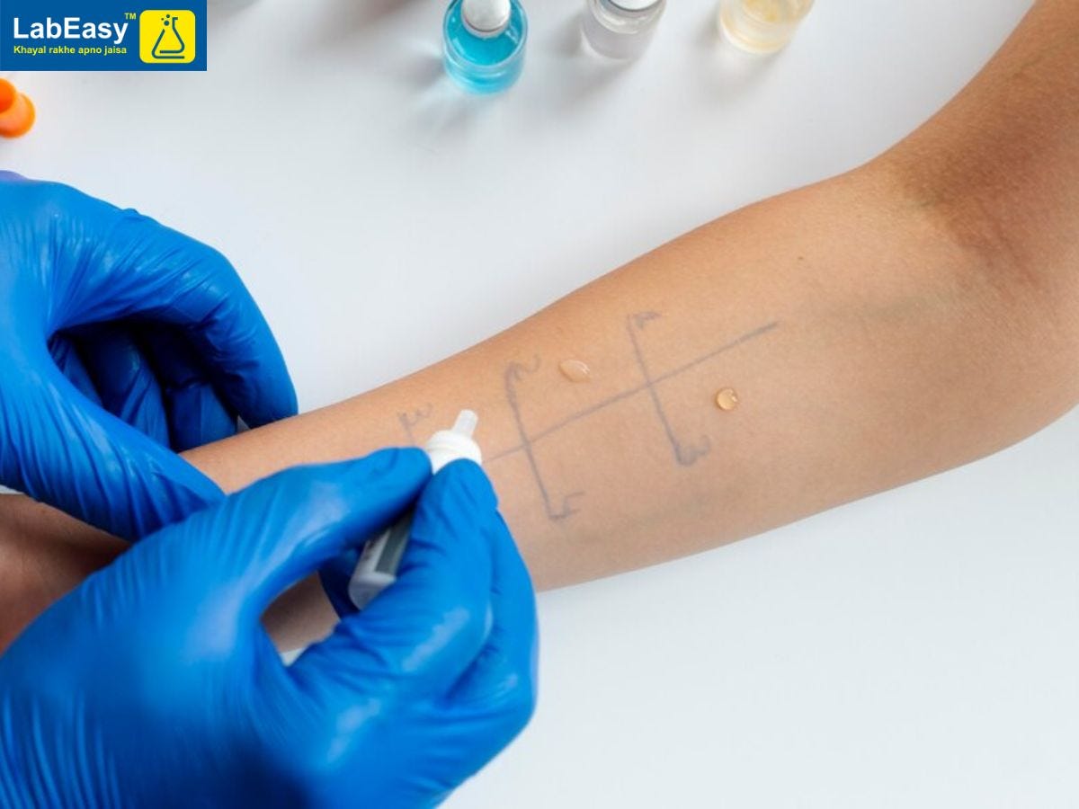 Allergy Test Center In Pune. Introduction: In the bustling city of ...