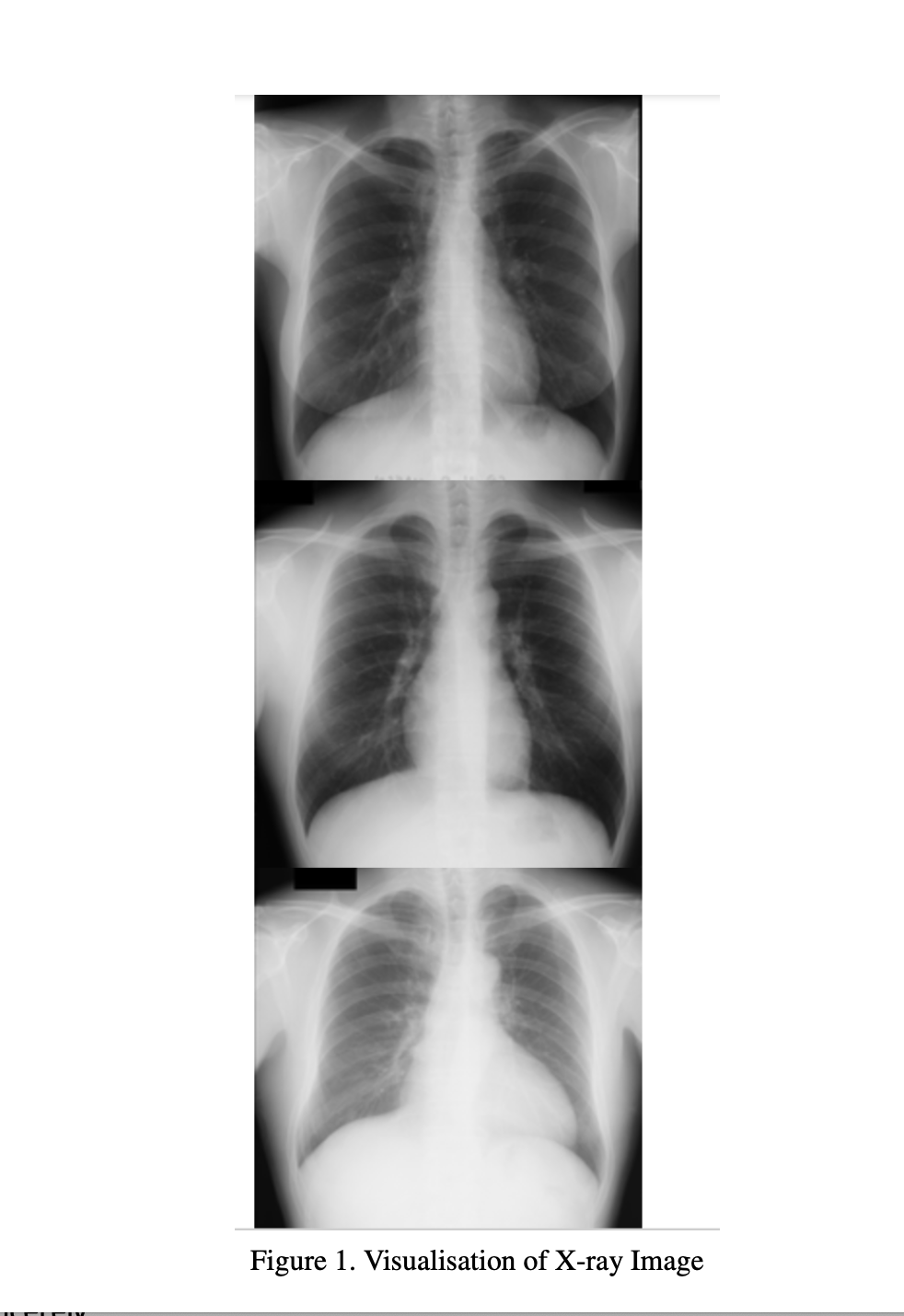 Building Your First Neural Network Image Classification With Mnist Fashion Dataset By Jude