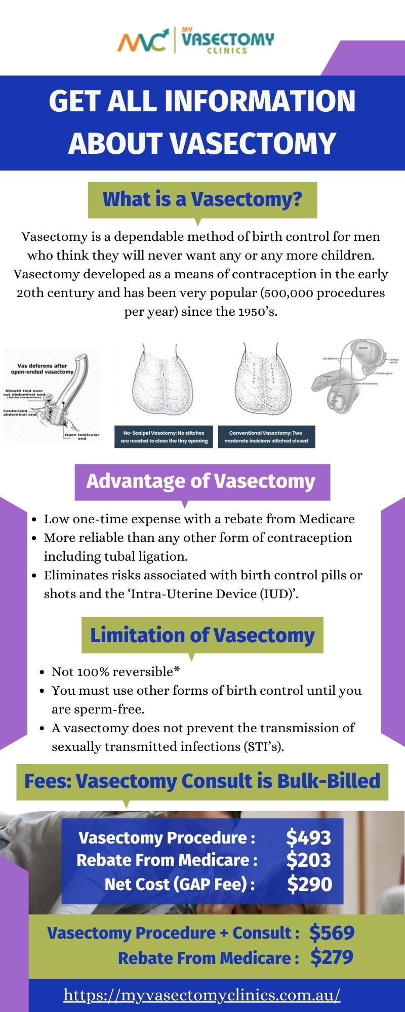 Which Method of Vasectomy Is The Best? — Traditional or No Scalpel ...