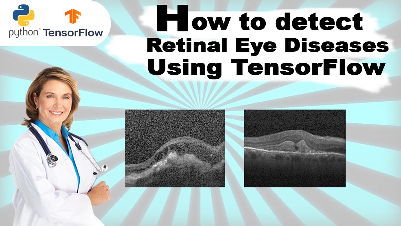 How to classify monkeys images using convolutional neural network , Keras tuner hyper parameters ...