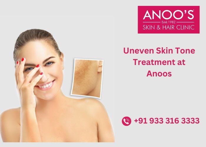Understanding the Causes of Acne: A Guide to Effective Treatment | by ...