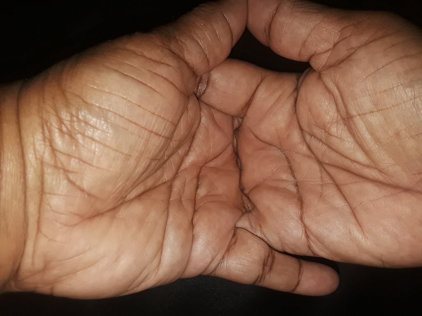 Cursed With Pain?. There are people who seem to have an… | by Sandra M ...