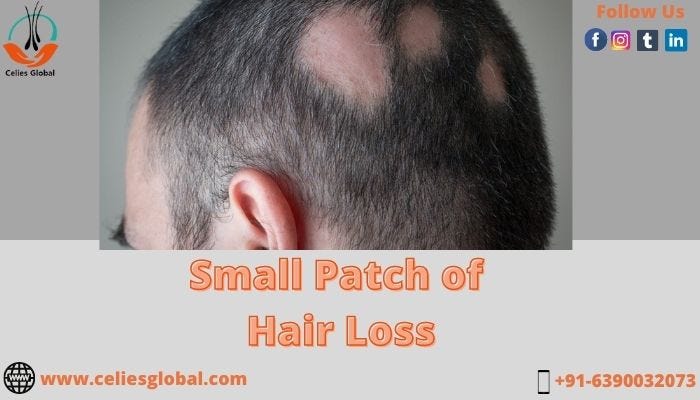 Hair Bonding in Noida - Celiesglobal - Medium