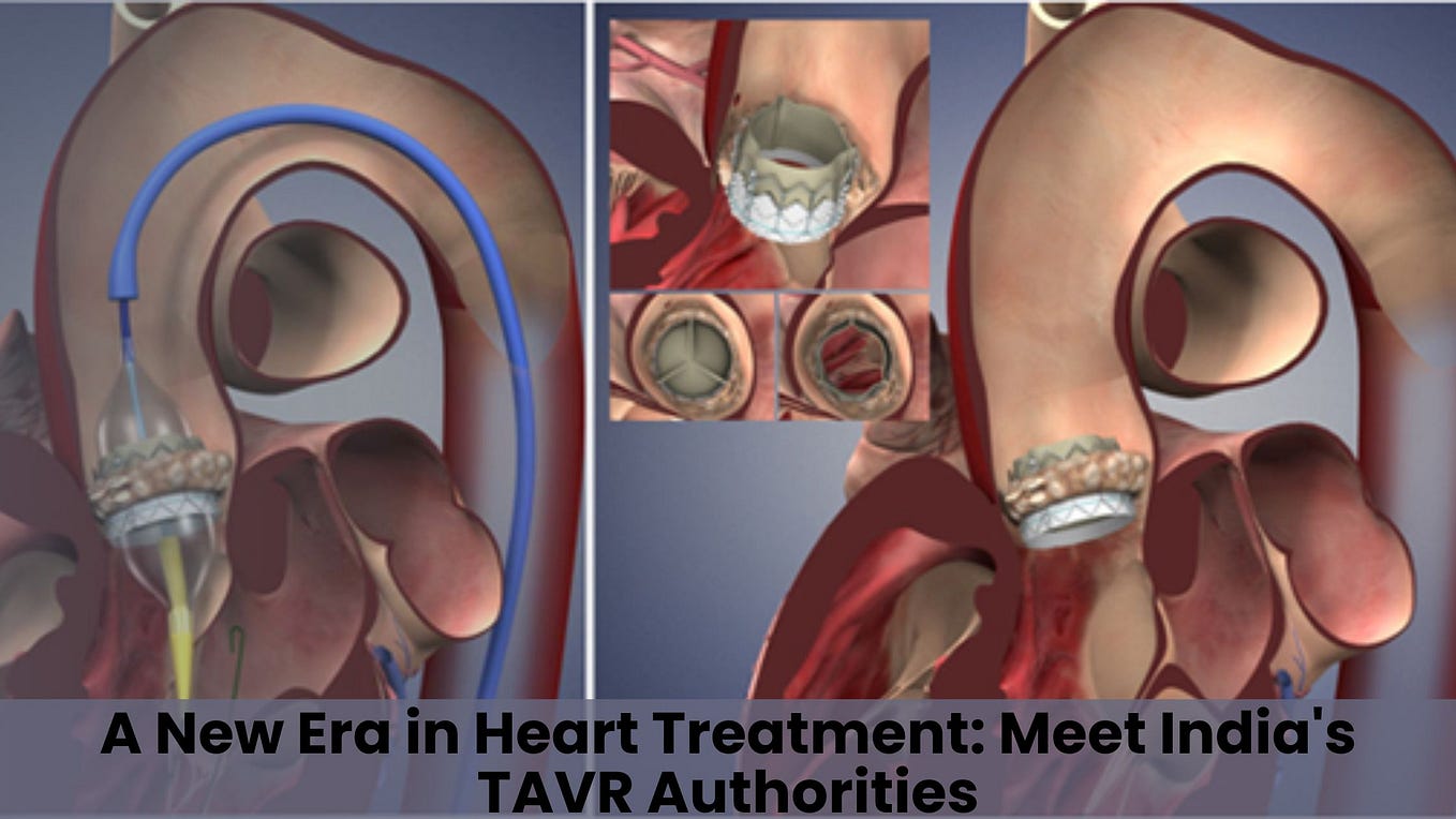 How the Heart Siphons Blood | by Dr Prashant Dwivedi | May, 2024 | Medium