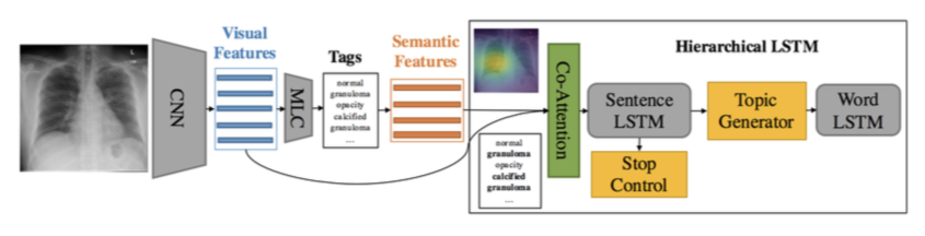 Understanding Cost function for Linear Regression | by Daketi Yatin ...