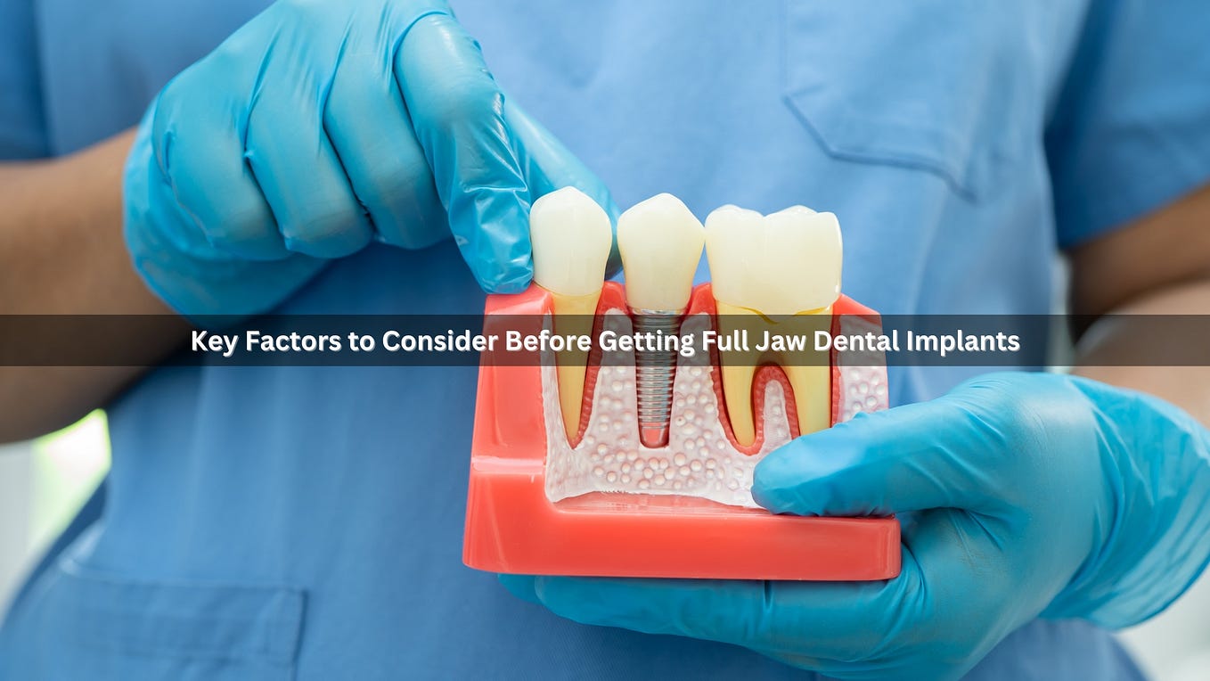 Exploring Insurance Coverage Options for Full Mouth Dental Implants ...