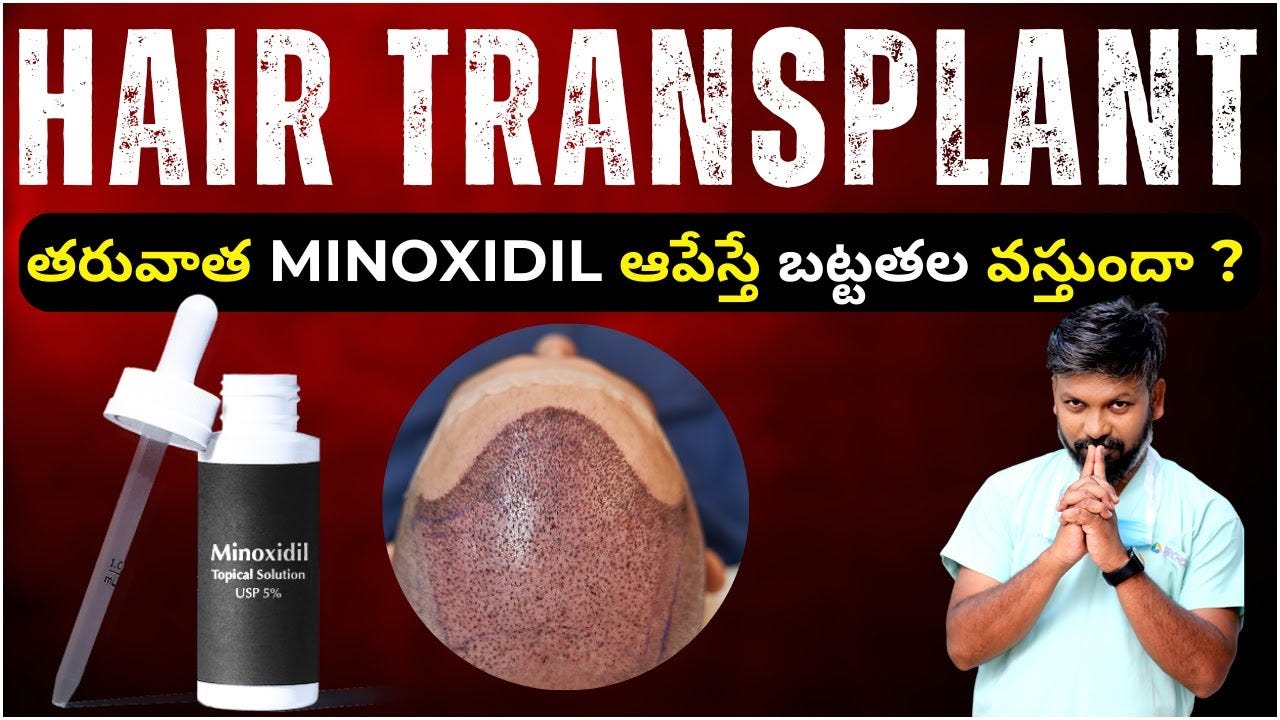 What is the difference between Oral Finasteride and Topical Finasteride ...