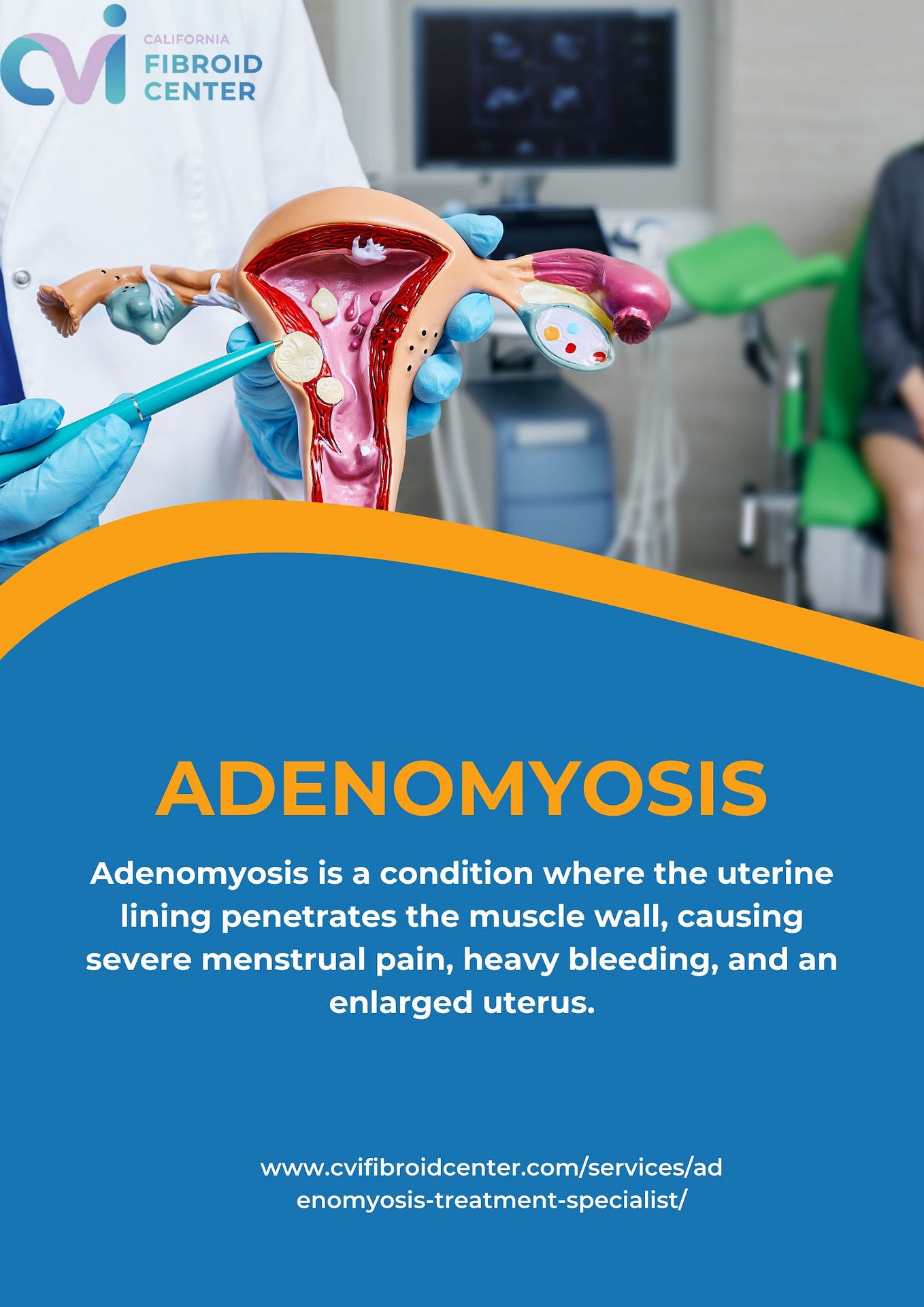fibroid surgery - Cvifibroidcenter - Medium