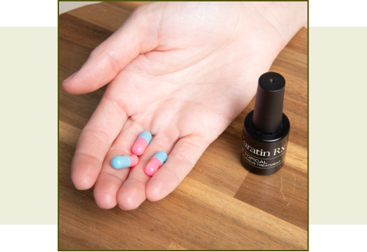 Signs and Stages of Nail Fungus Progression - Caratin Rx - Medium