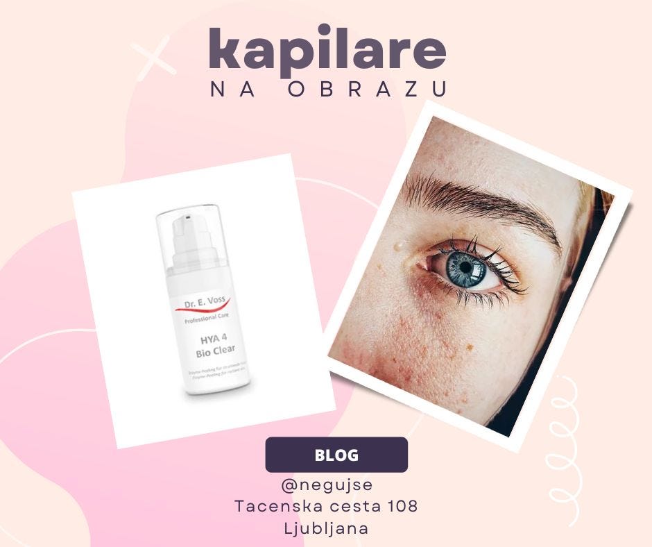 Kapilare na obrazu ali kuperoza | Kako si pomagamo? | Medium