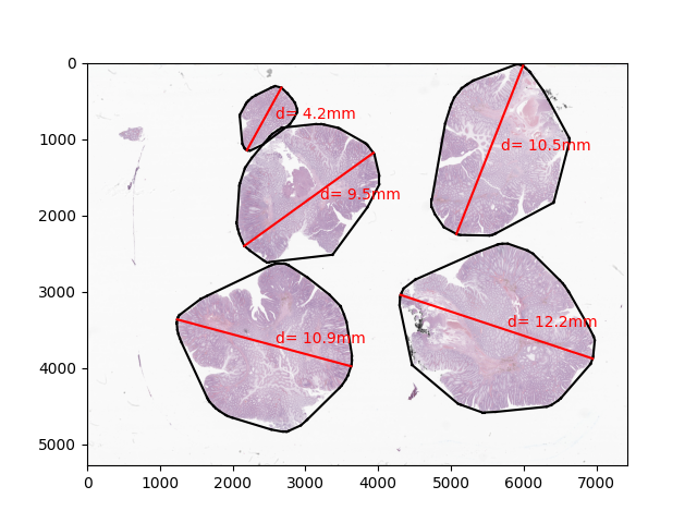 YOLOv8: A Comprehensive Framework for Object Detection, Instance ...