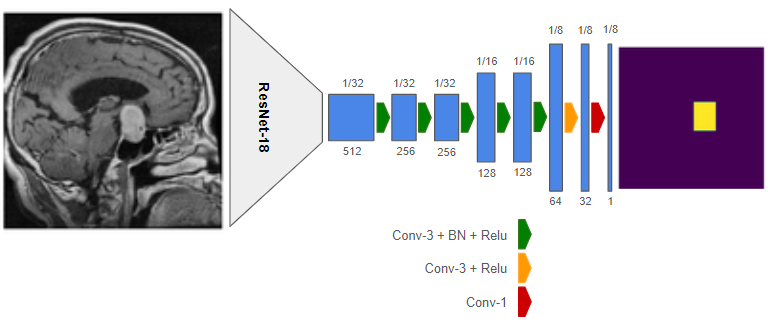Multi Class Semantic Segmentation With U Net And Pytorch By Mohammad Hamdaan Medium