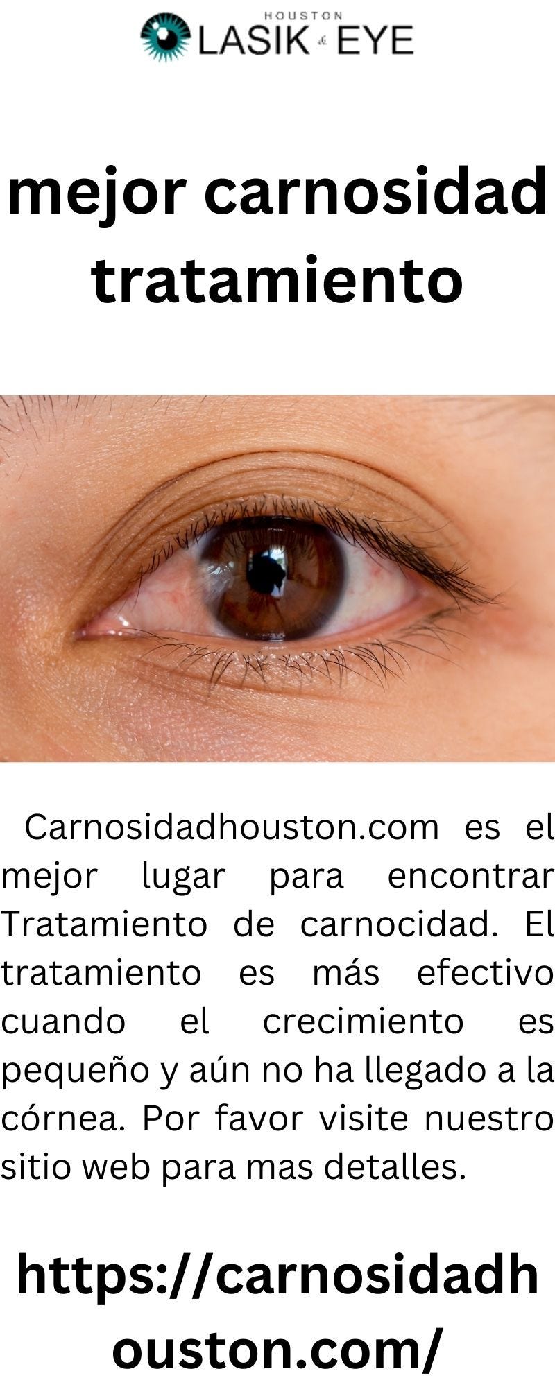 carnosidad cirugia - Hustonlasikeye - Medium