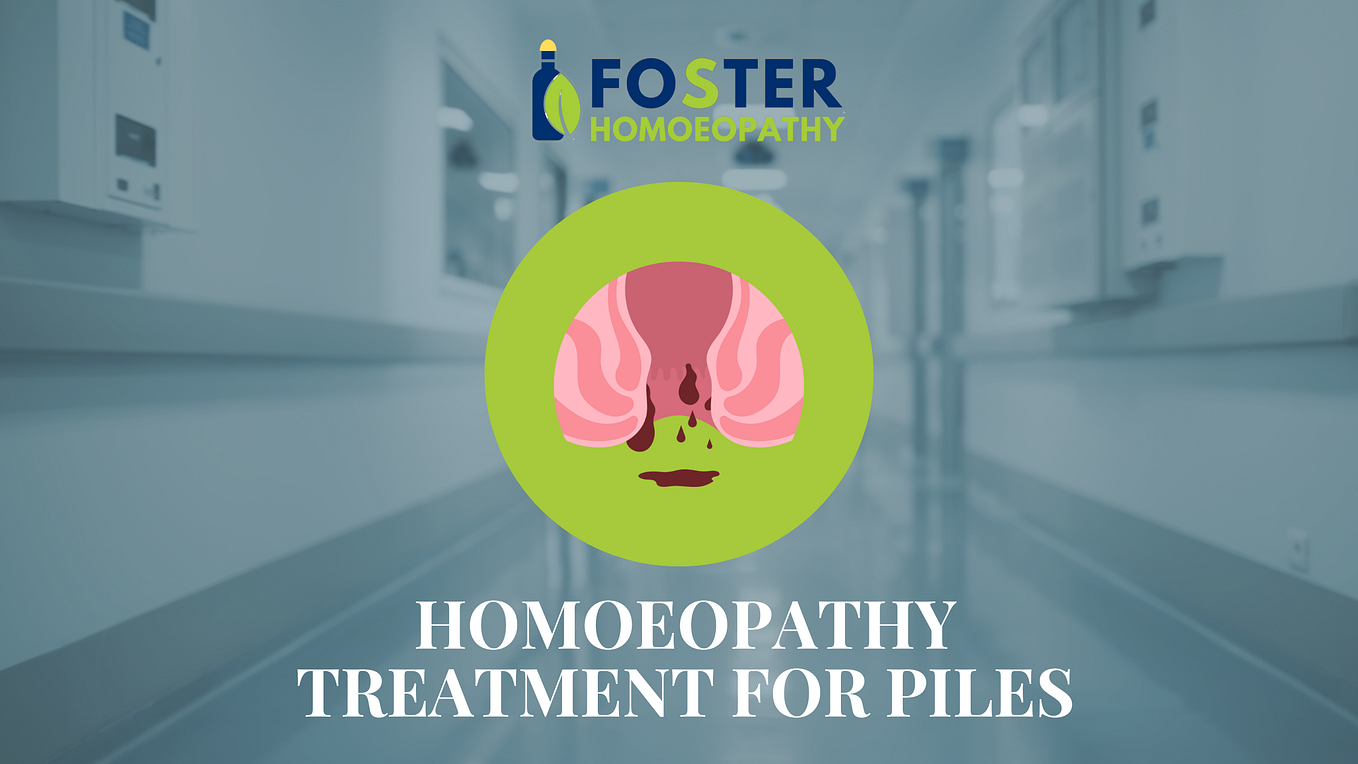 Homoeopathy Treatment for Alopecia: A Natural Approach to Hair Loss ...
