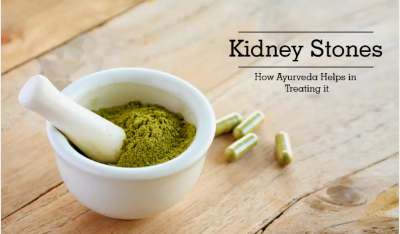 Ouch! Kidney Stones: How to Prevent, Pass, and Dissolve Them Naturally ...