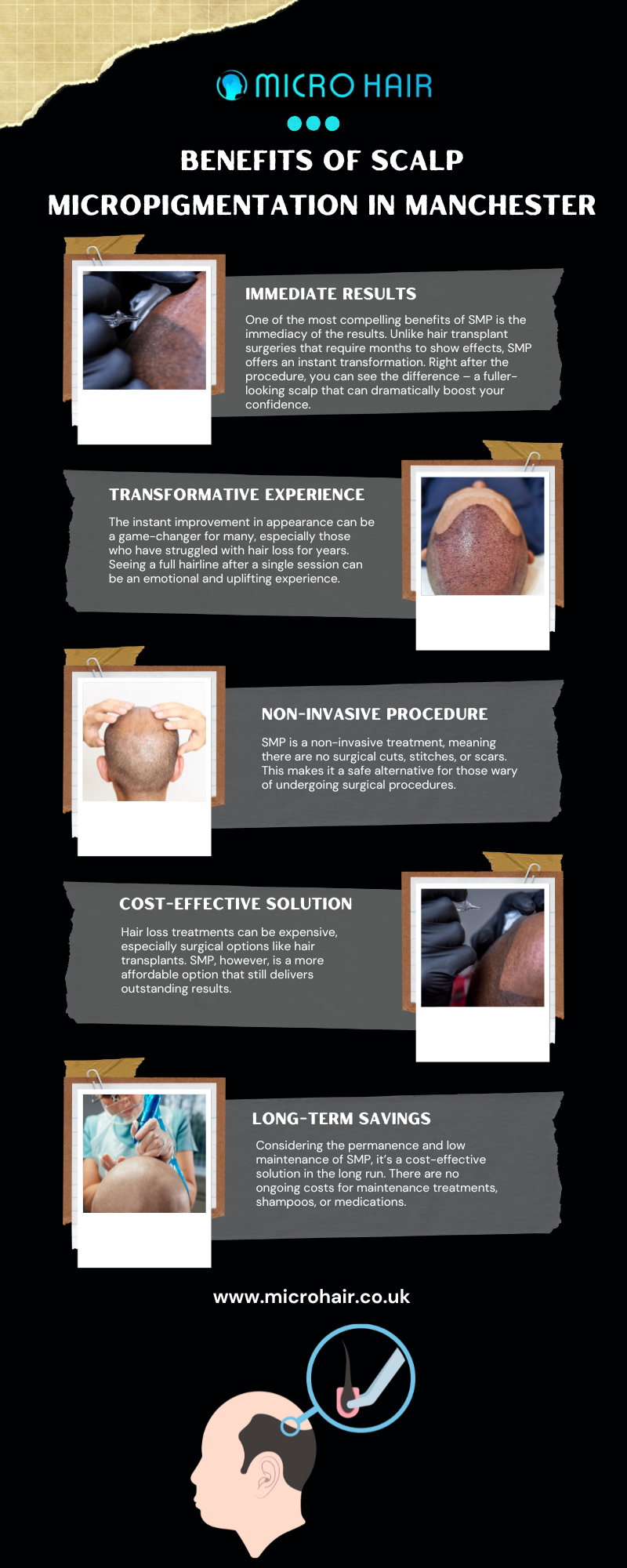 Hairline Pigmentation in Manchester Transforming Hairlines with ...