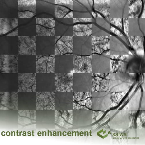 The Essential Guide to Data Augmentation in Deep Learning | by Saiwa ...